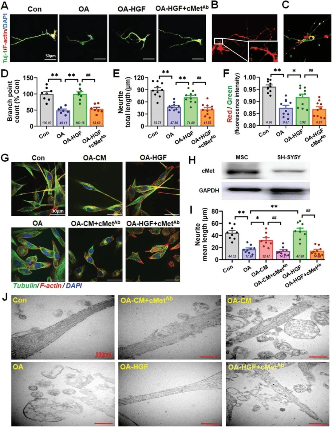 Adv Sci：干细胞治疗阿尔兹海默症的分子机理_hUC-MSCs
