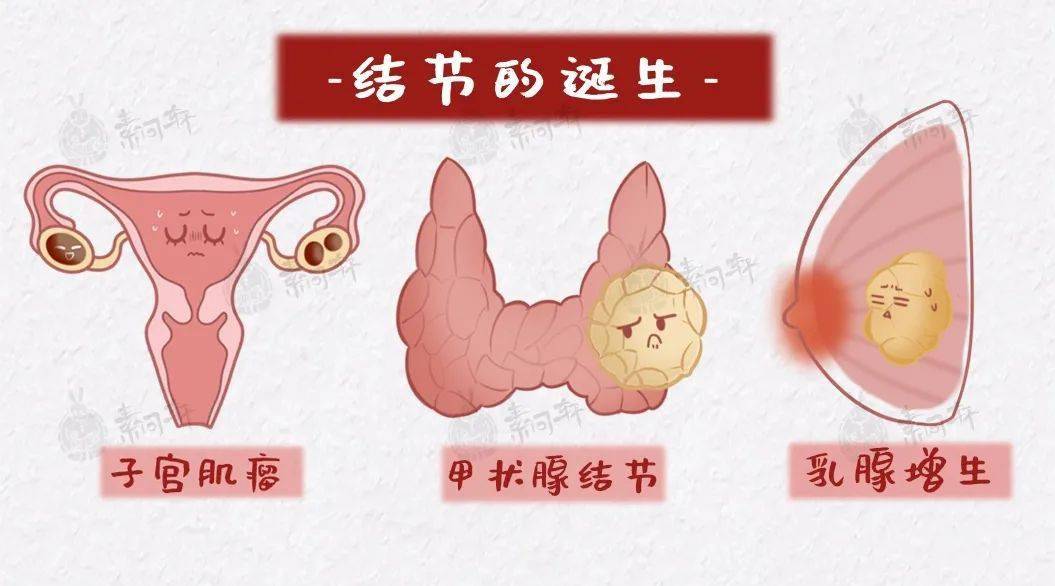 结节、肌瘤，囊肿都是一条藤上结出的歪瓜，切了还会长！中医可以一方通治乳腺