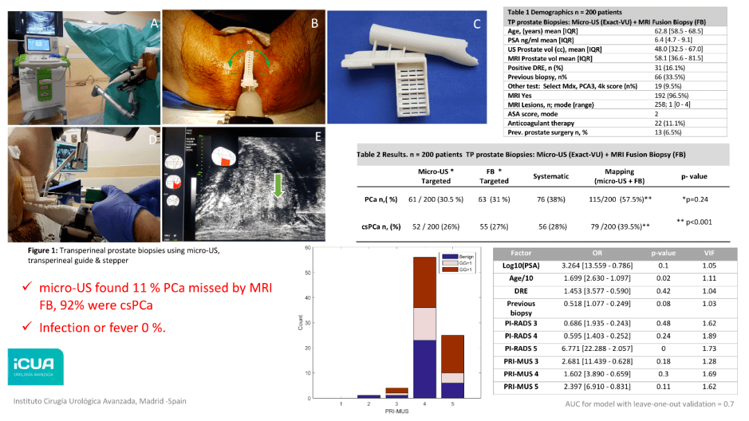 益普生直击2020 EAU丨前列腺癌mpMRI及穿刺活检最新进展_诊断