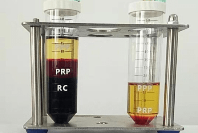 PRP-新的治疗选择_血小板