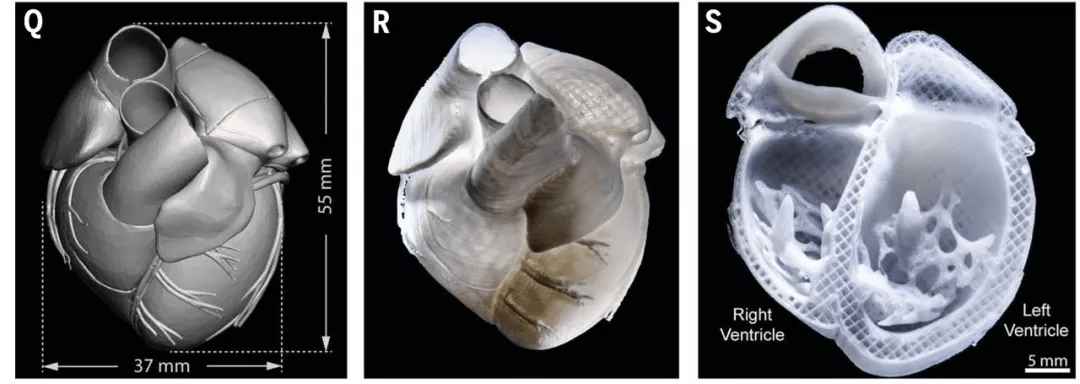 《Science》重磅 | 美科学家成功生物3D打印胶原心脏_研究