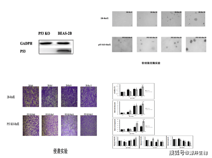 CRISPR基因编辑BEAS-2B细胞系——希望就在呼吸之间—源井生物_研究