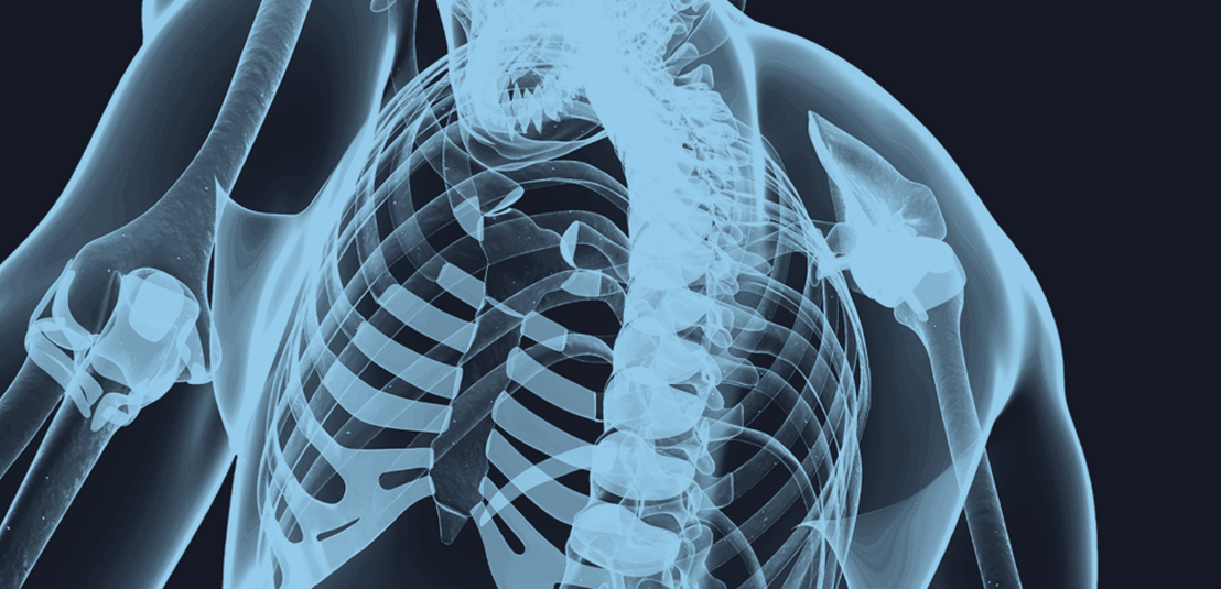 Novadip Biosciences获得1900万欧元B轮融资_临床