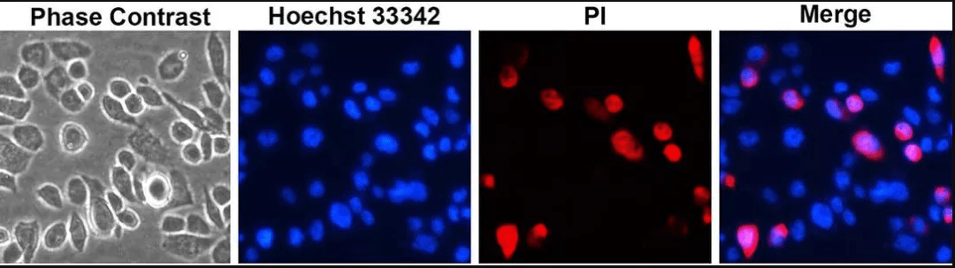 细胞凋亡的检测方法有那哪些？_Annexin_Caspase-_实验