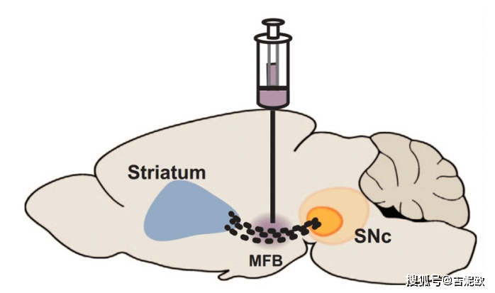 大鼠6-OHDA诱导帕金森病动物模型 6-OHDA损毁建立完全损伤动物实验小鼠模型_of_the_神经元