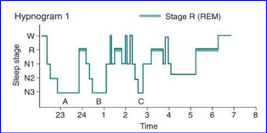 【睡眠科普】不同年龄阶段正常睡眠结构_时间_婴儿_周期性