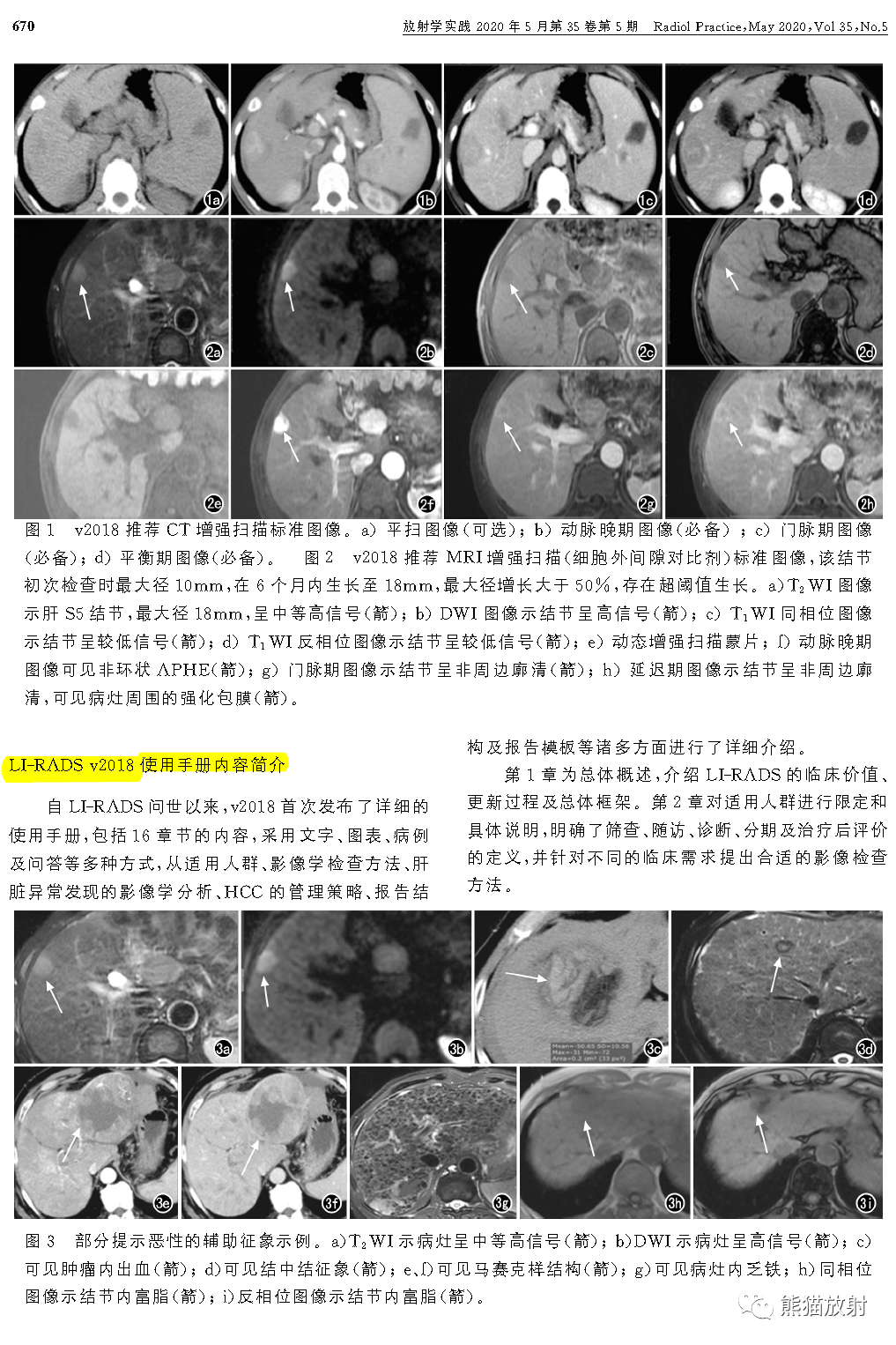 综述丨肝脏影像报告及数据系统（LI-RADS）2018版更新解读_诊断