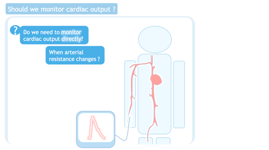PiCCO在ICU中的应用_进行