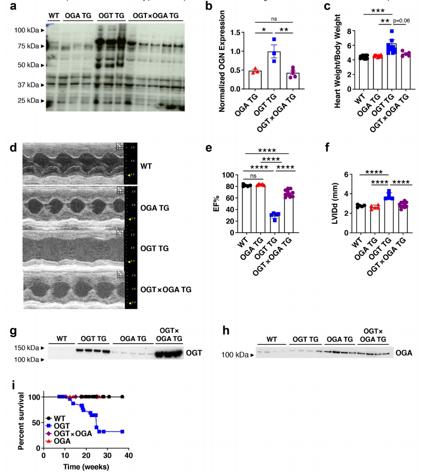 探索 | O-GlcNAcylation水平过高将诱发心力衰竭和猝死_心肌