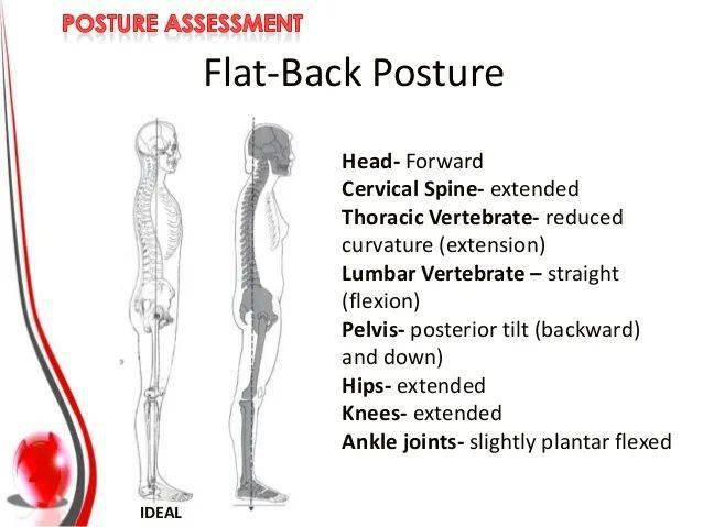 这样抬头挺胸，居然比驼背还伤身？_胸椎