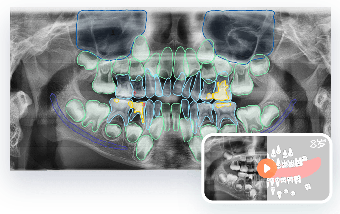 36氪首发 | 用AI技术切入激增的口腔赛道，松柏投资与「羽医甘蓝 DeepCare」达成战略合作_医疗