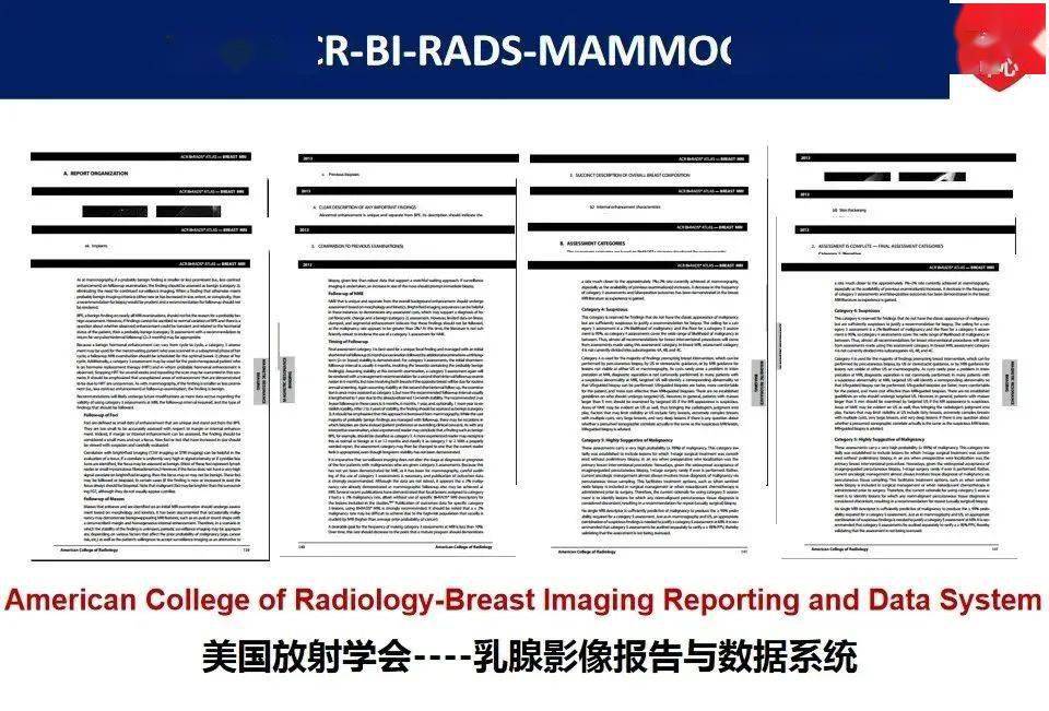 最新版乳腺X线 BI-RADS 分类解读_检查