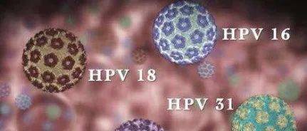HPV知晓日系列活动----HPV到底是个啥？_病毒_筛查_传播