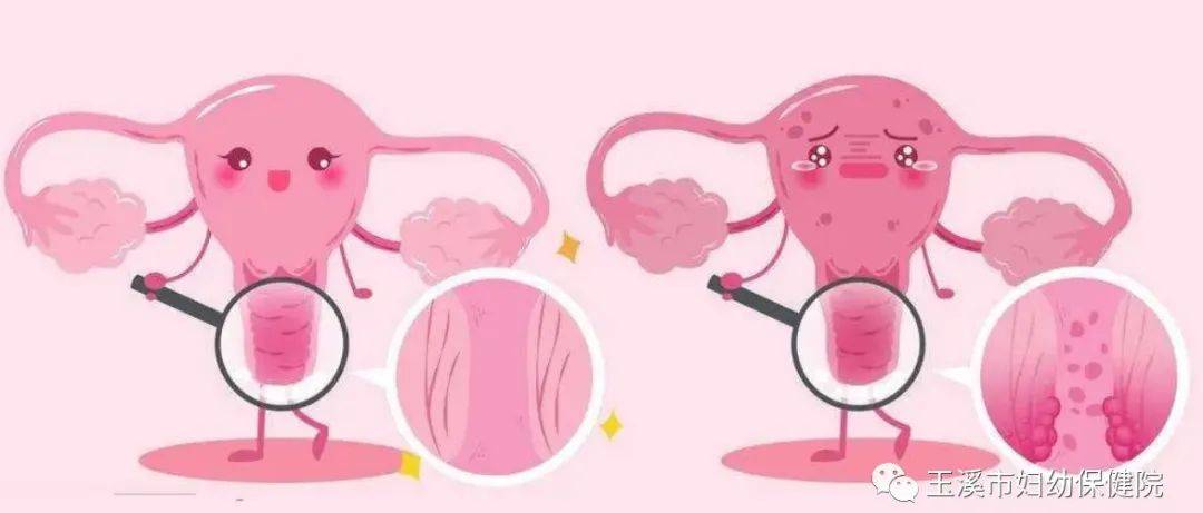 科普|远离宫颈癌,你要知道这些~筛查病变女性