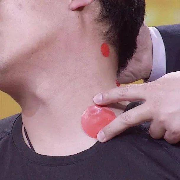 颈部这里最易长筋结,一定要揉开 蓝葡维疾病方案