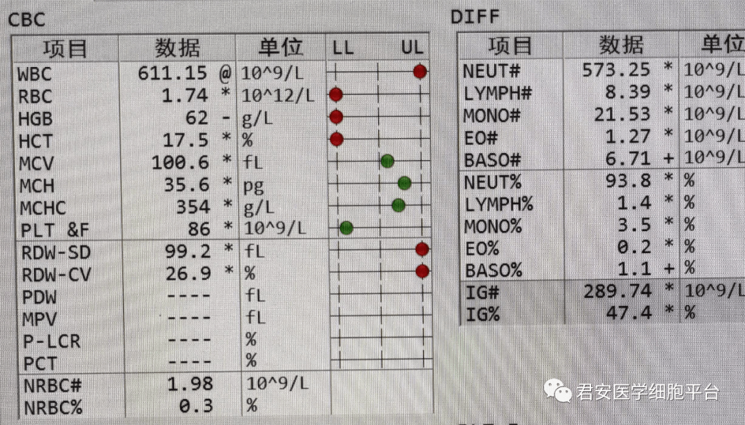一例慢性髓细胞白血病（CML-CP）病例分享_治疗_骨髓_患者