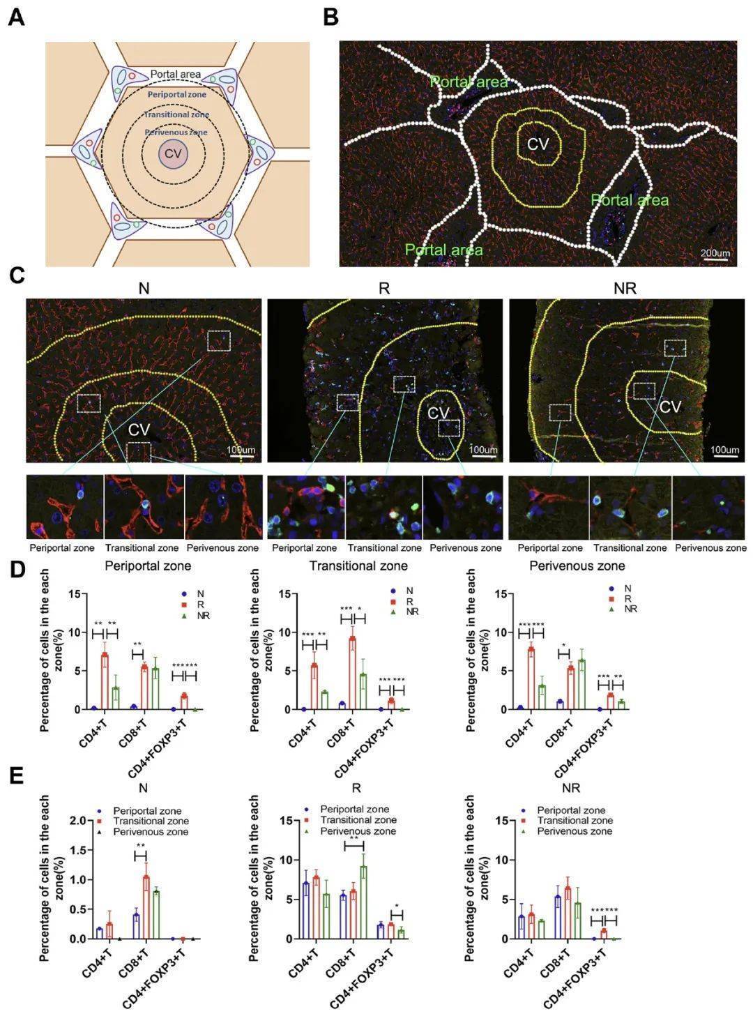 肝移植组织微环境研究，多重荧光免疫组化有这些新发现！ - 企业动态 - 丁香通