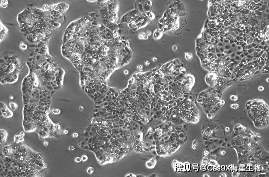 人结直肠腺癌细胞(Caco-2)培养要点_细胞系_贴壁_培养基