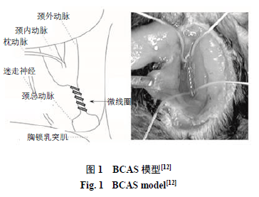 脑小血管病实验动物模型及制备方法研究进展_common_病理_动脉