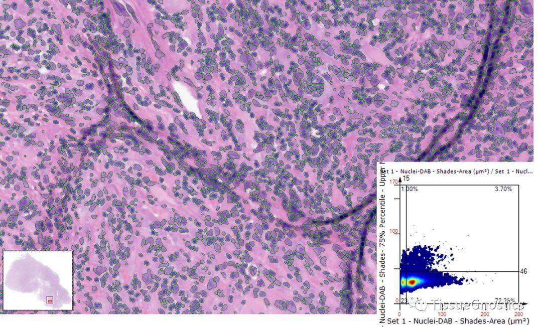 TissueGnostics公司H&E染色样本定量分析实例_识别_苏木_细胞核