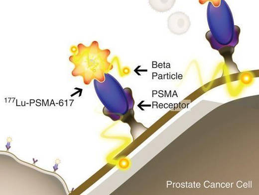前列腺癌精准疗法！欧盟CHMP建议批准PSMA靶向放射配体疗法Pluvicto_治疗_患者_研究