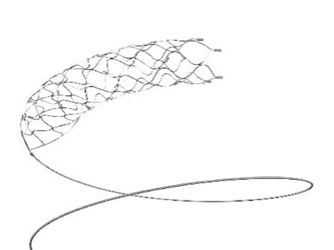 进博会：美敦力的黑科技来了_产品_参展_系统