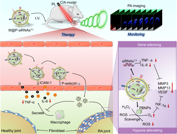 科学家提出类风湿关节炎诊疗新策略_研究_治疗_siRNAT