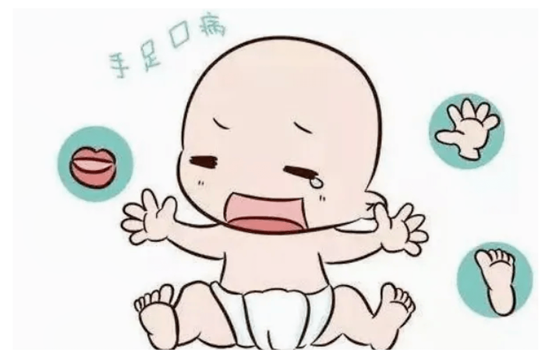 接种EV71疫苗不妨多说一句_家长_病毒_重症