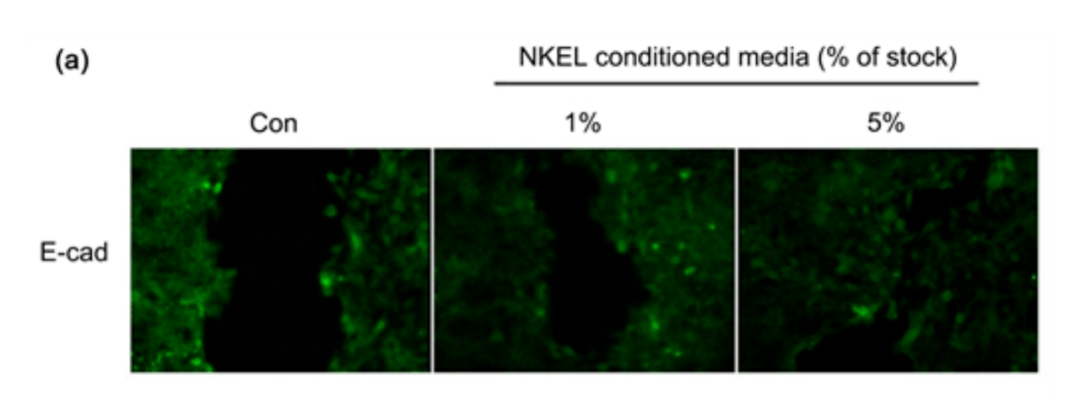 新研究证实，NK细胞上清液可以抗皮肤老化_影响_角质_的作用