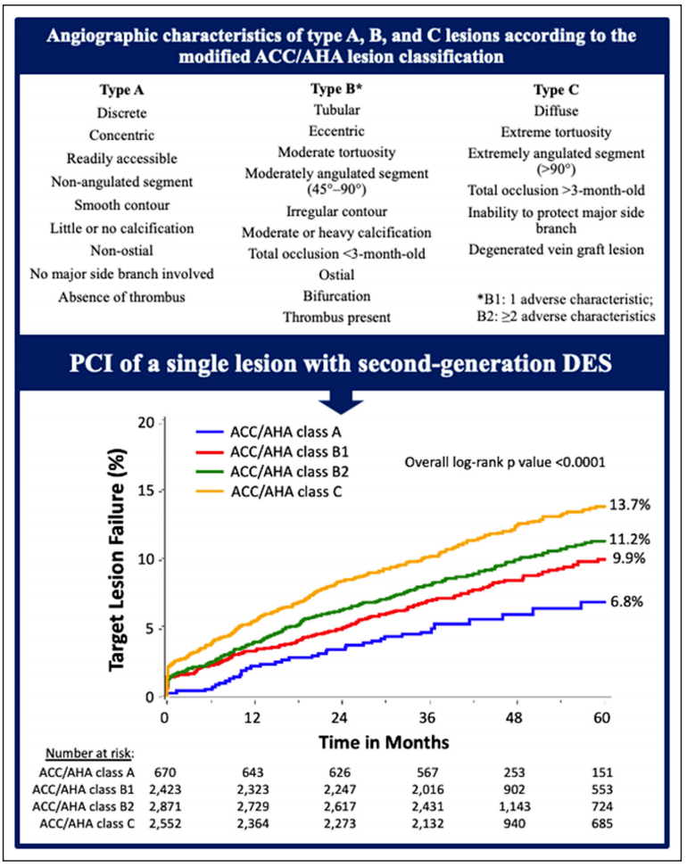 资讯丨ACC/AHA病变分型还能预测药物洗脱支架介入治疗冠心病患者的预后吗？_研究_冠脉_血管
