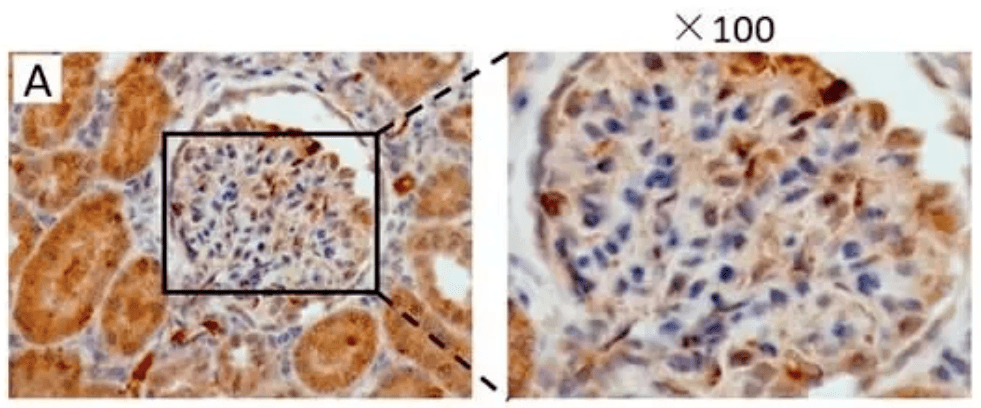 IHC/IF 结果如何统计、作图？一篇讲全_实验_荧光_丁香
